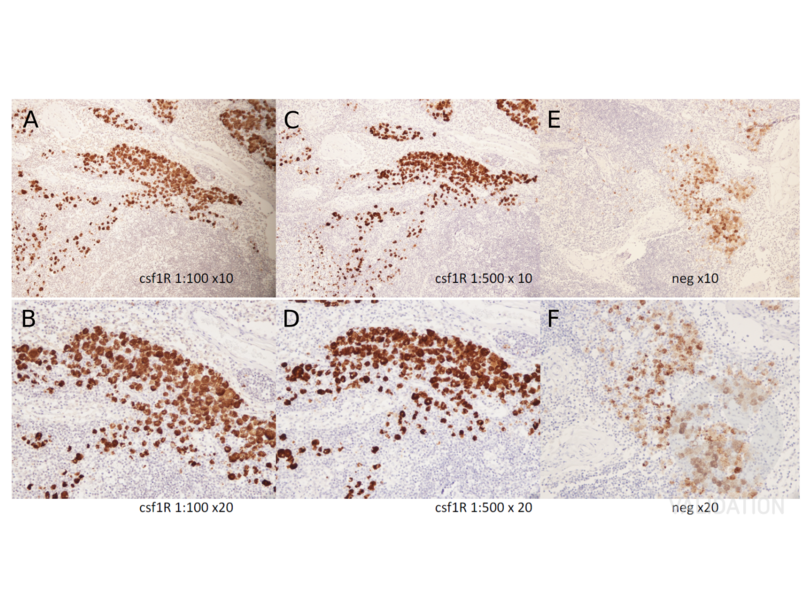 CSF1R Antibodies