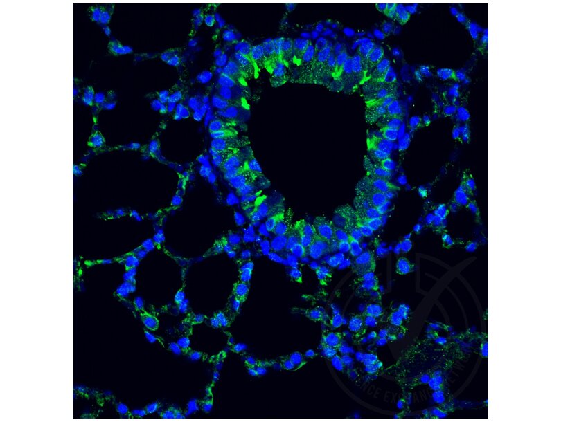 TNF alpha Antibodies