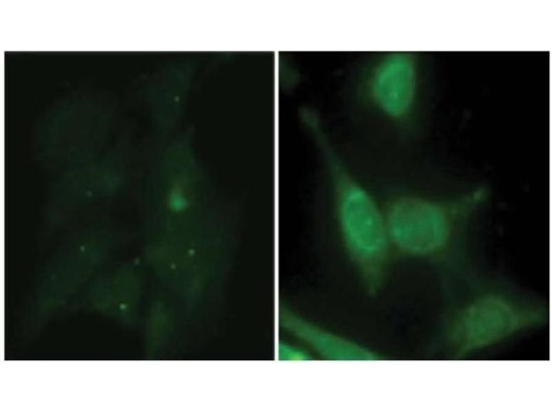 anti-PtdIns(3)P Antibody [ABIN7581196] - Various Species, ELISA, ICC, PLO