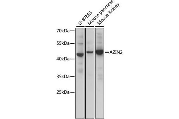 ADC Antibodies